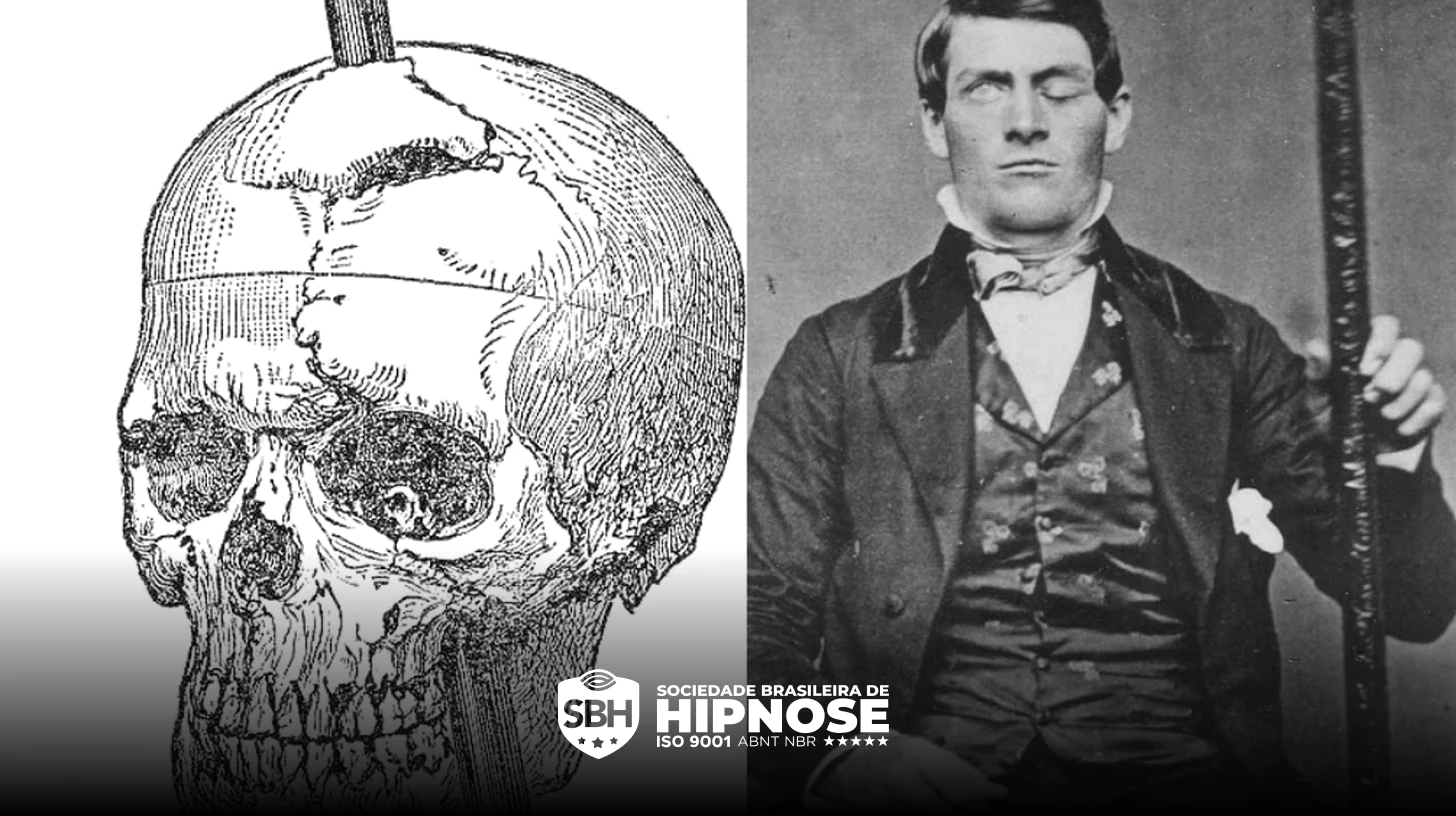 Phineas Gage: Como um Acidente Moldou a Neurociência